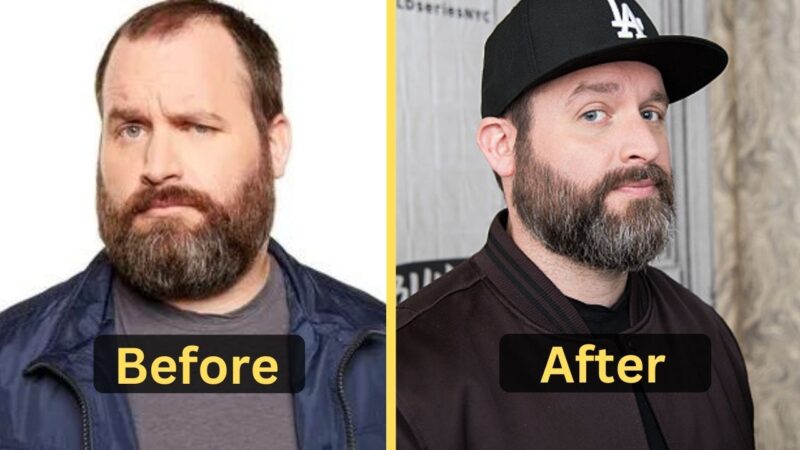 Tom Segura Weight Loss: Diet Plan, Workout, Surgery, Before & After ...